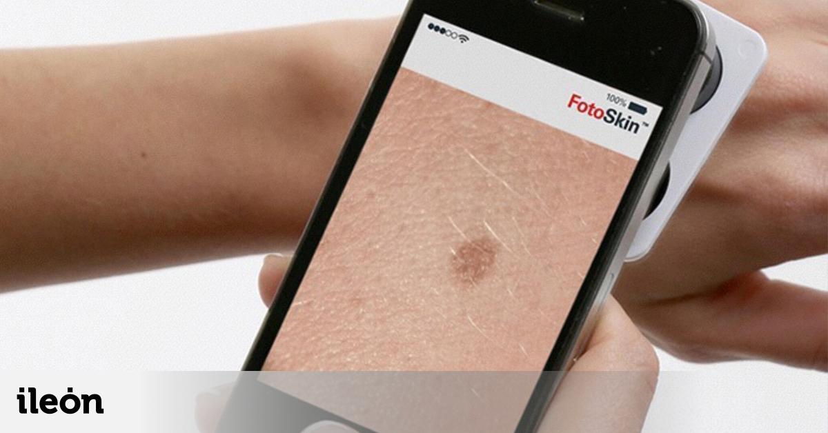 Una aplicación de prevención y diagnóstico del cáncer de piel, 'Mejor ...