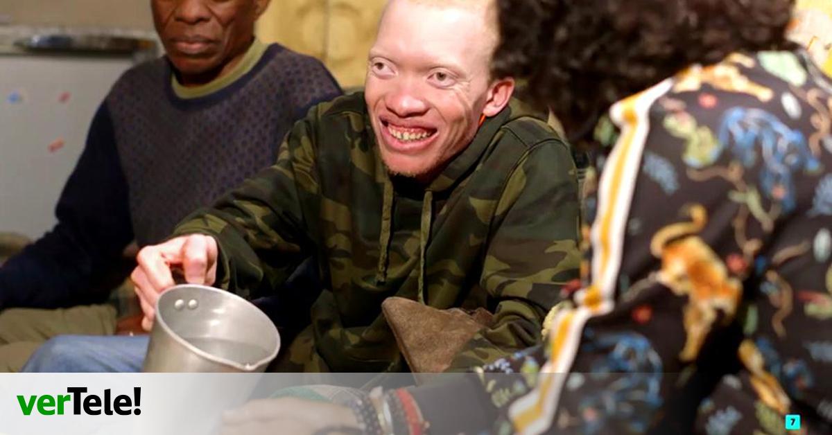 Se llama Malvin, es negro albino y el mejor tipo que vas a conocer en TV