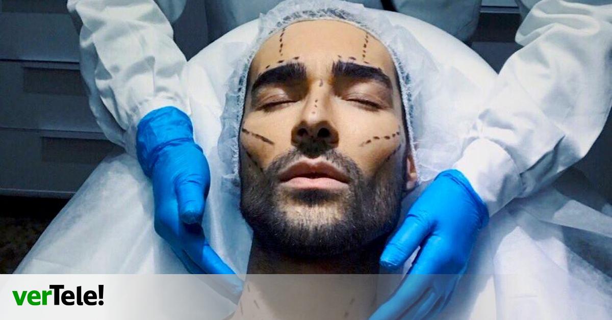 Miguel ('GH 17') se fotografía en plena operación estética y hace apología