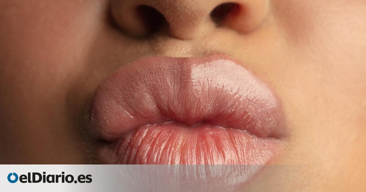 Las 3 Mejores Clínicas De Aumento De Labios En Madrid Somos Malasaña