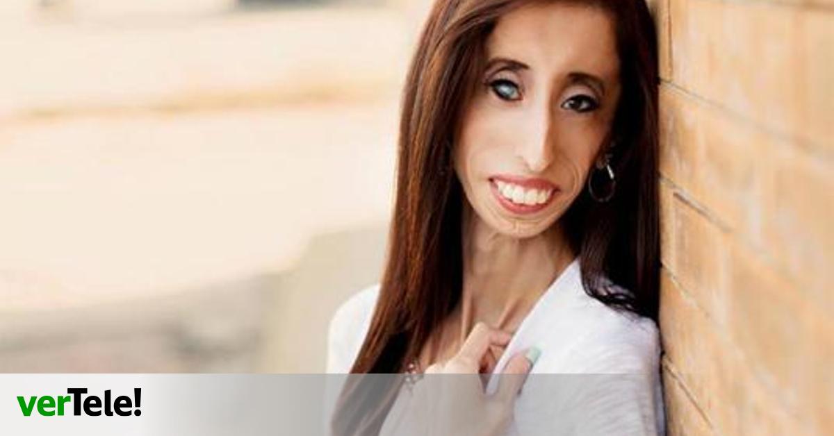 El testimonio de "la mujer más fea del mundo" emociona a la red