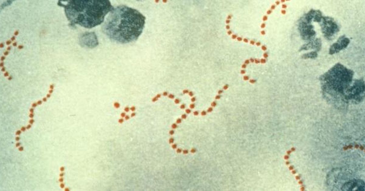 Cinco menores hospitalizados en Andalucía por estreptococo del grupo A ...